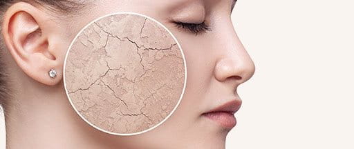 Sequedad en la piel: rutina diaria de cuidados | Eucerin®