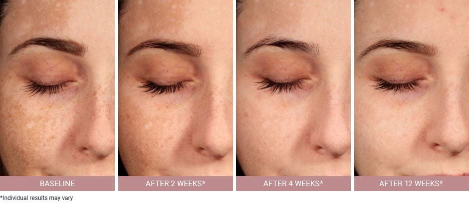 Even Pigment Perfector | Uneven Skin Tone| Eucerin