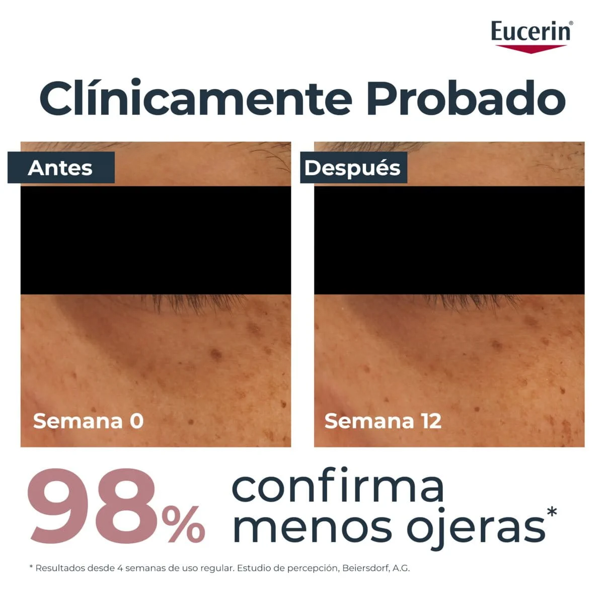 Eucerin Anti-Pigment Crema Anti-Ojeras