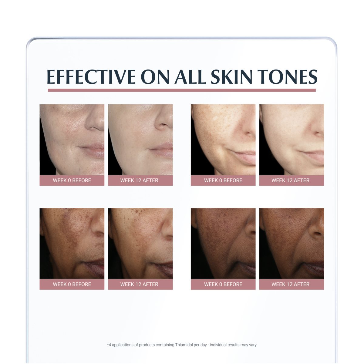 Hyperpigmentation Dual Serum | Reduce Pigment Spots | Eucerin