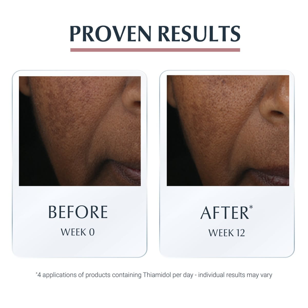 Anti-Pigment Dual Serum