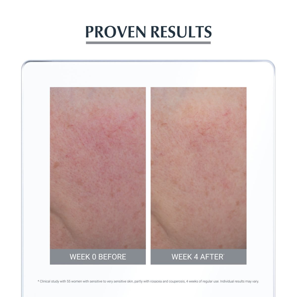 AntiRedness Soothing Cream for Hypersensitive Skin | Eucerin