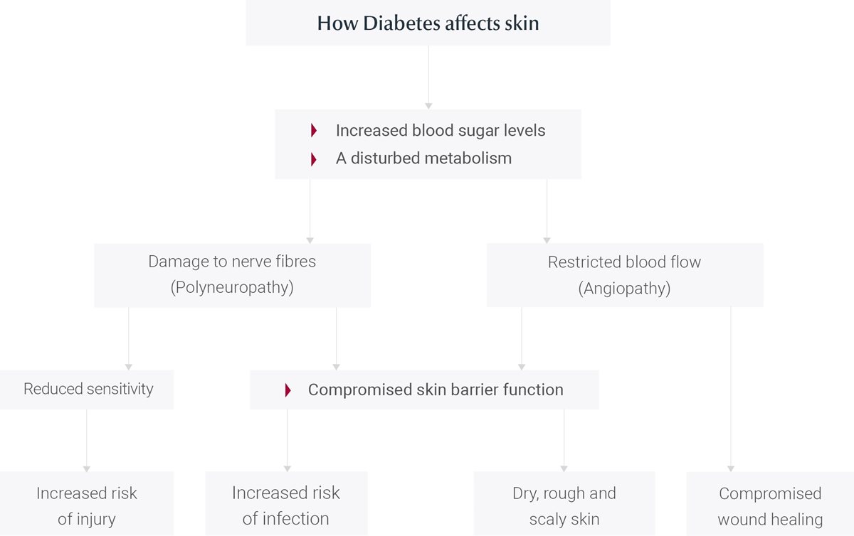 Skin care with Urea for Diabetes | UreaRepair | Eucerin