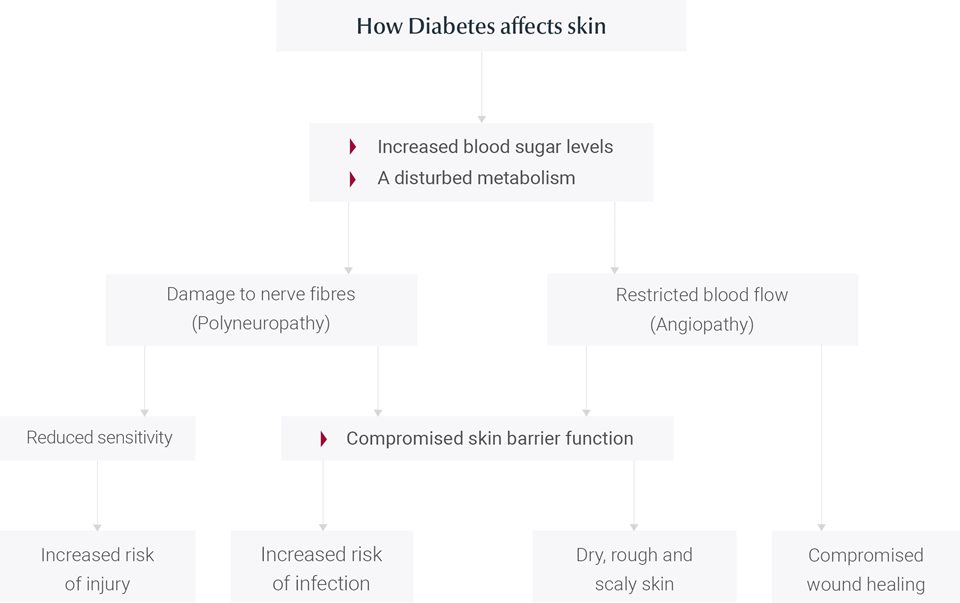 Skin care with Urea for Diabetes | UreaRepair | Eucerin