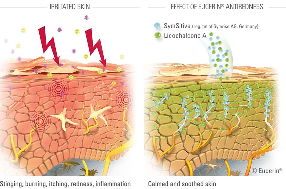 Eucerin: Our research | Behind the science of Eucerin Hypersensitive