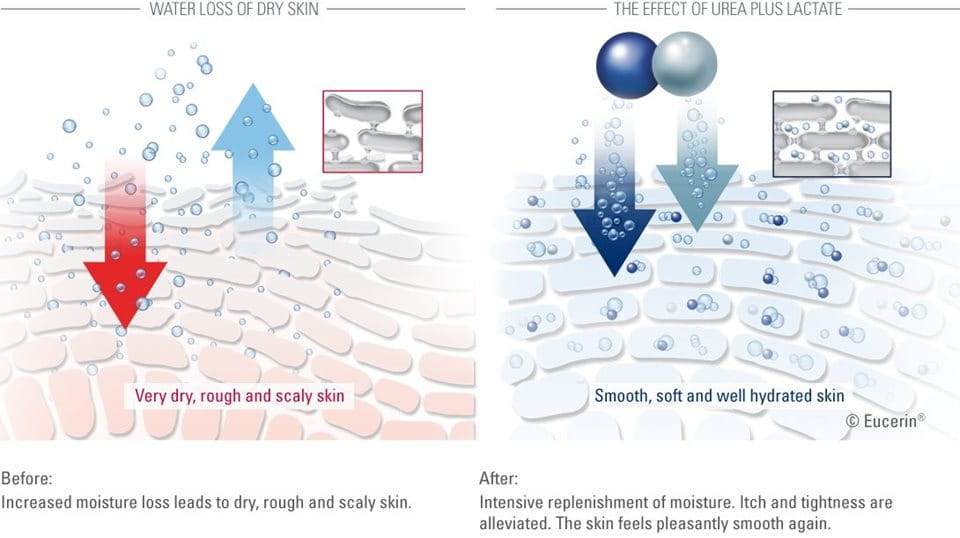 Eucerin: Urea | Replenishing Face Creme Day 5% Urea | Dry Skin