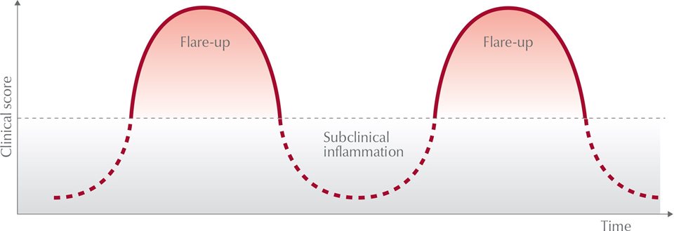 Eczema flare-up | Atopic Dermatitis | Eucerin