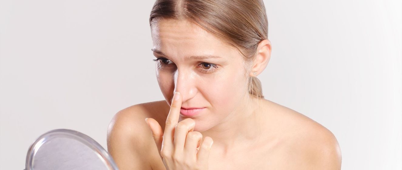 Wie lassen sich Mitesser entfernen? | Eucerin