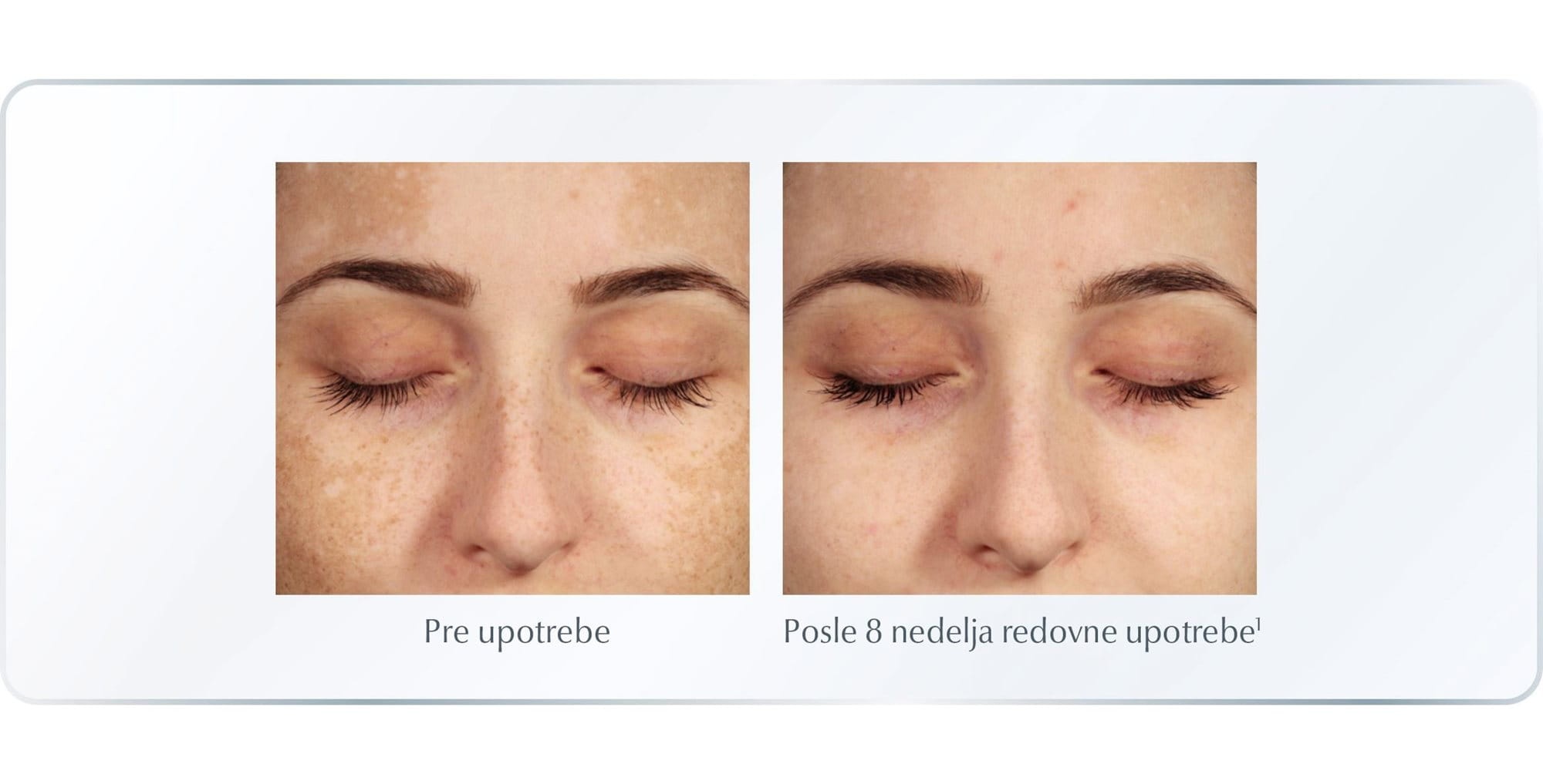 Anti-Pigment Korektor za sve tipove kože |korektor za tamne fleke| Eucerin