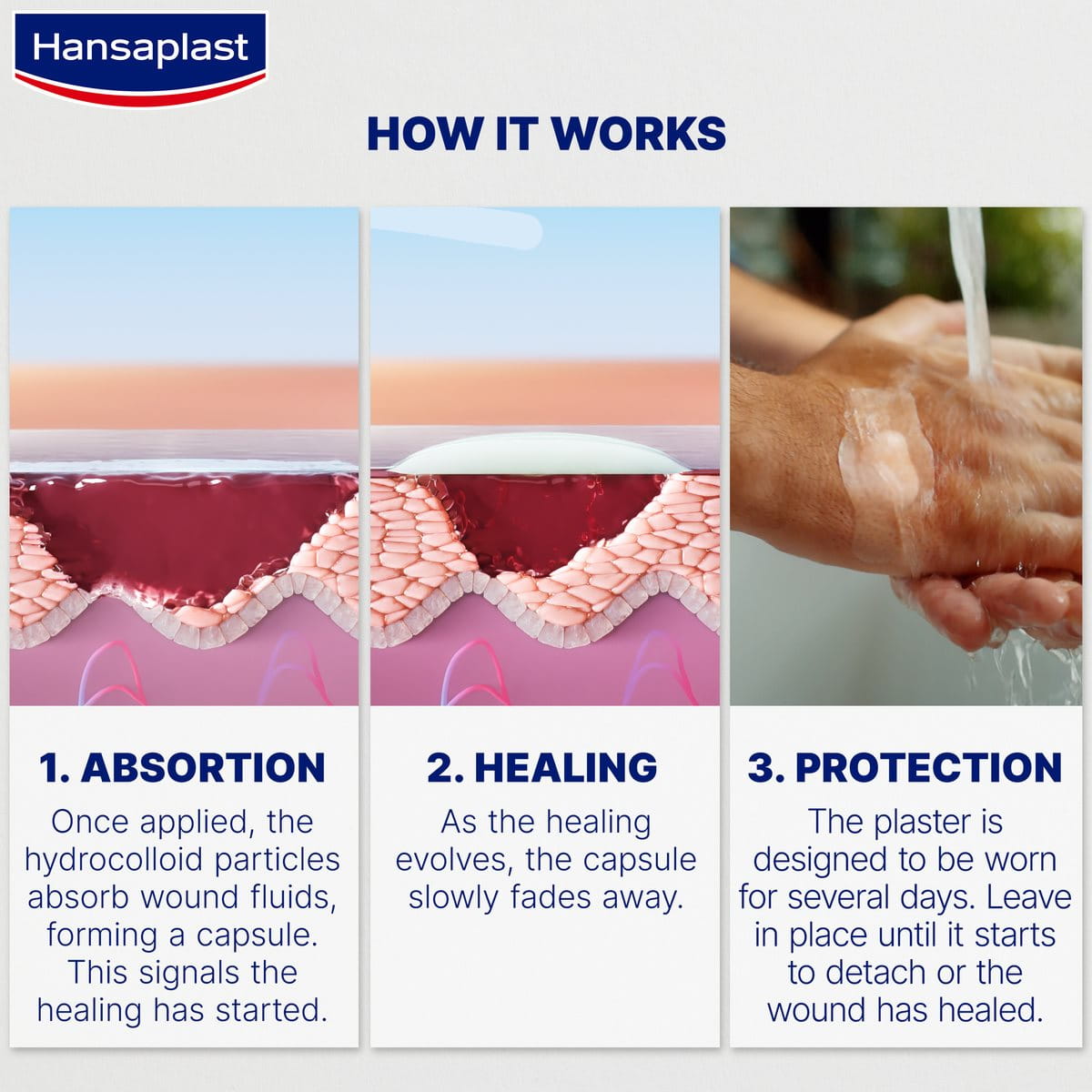 Hansaplast Second Skin Hydrocolloid: Enhanced Healing Plasters